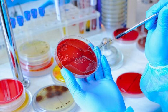 Cronobacter spp. (Enterobacter sakazakii) - NF Validation EN